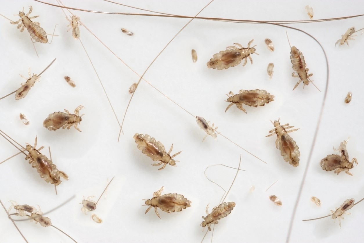 Body Lice Pictures Body Lice Pictures